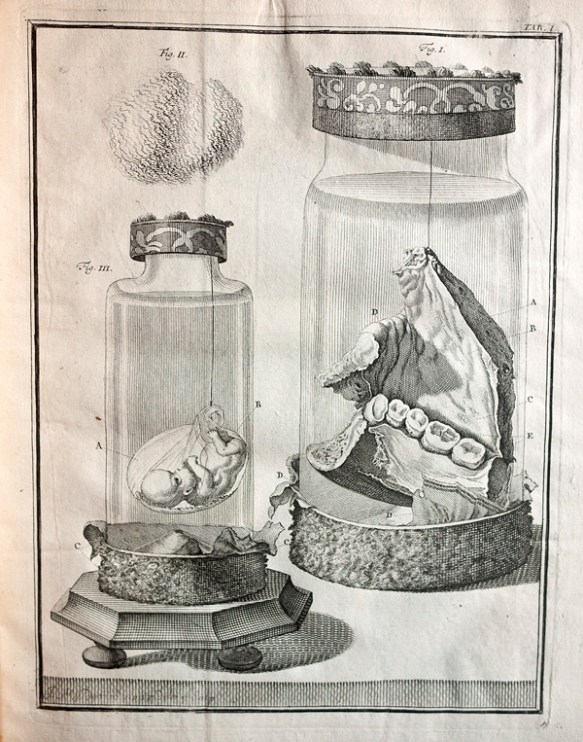 “Artist of Death” Frederik Ruysch at NYAM: Guest Post by Morbid Anatomy ...