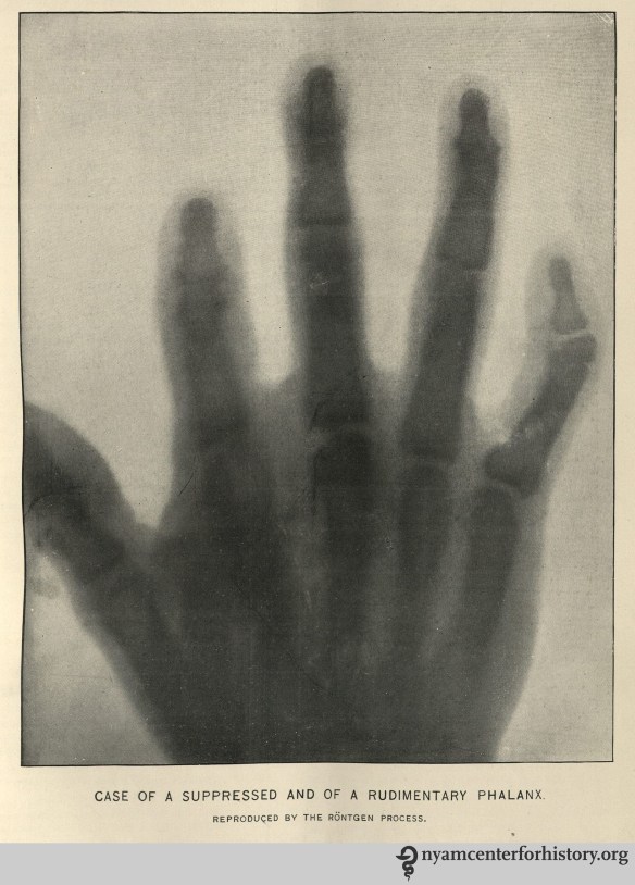 X-rays | Books, Health and History