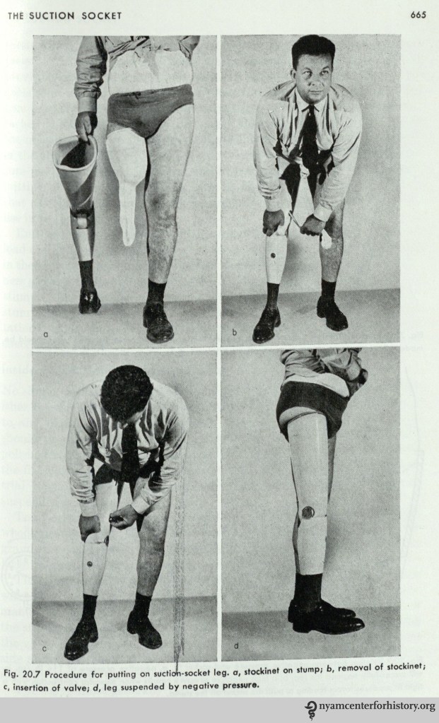 On Paré and Prosthetics | Books, Health and History