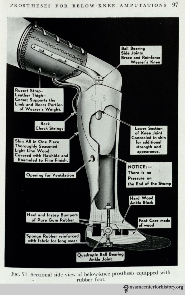 On Paré and Prosthetics | Books, Health and History