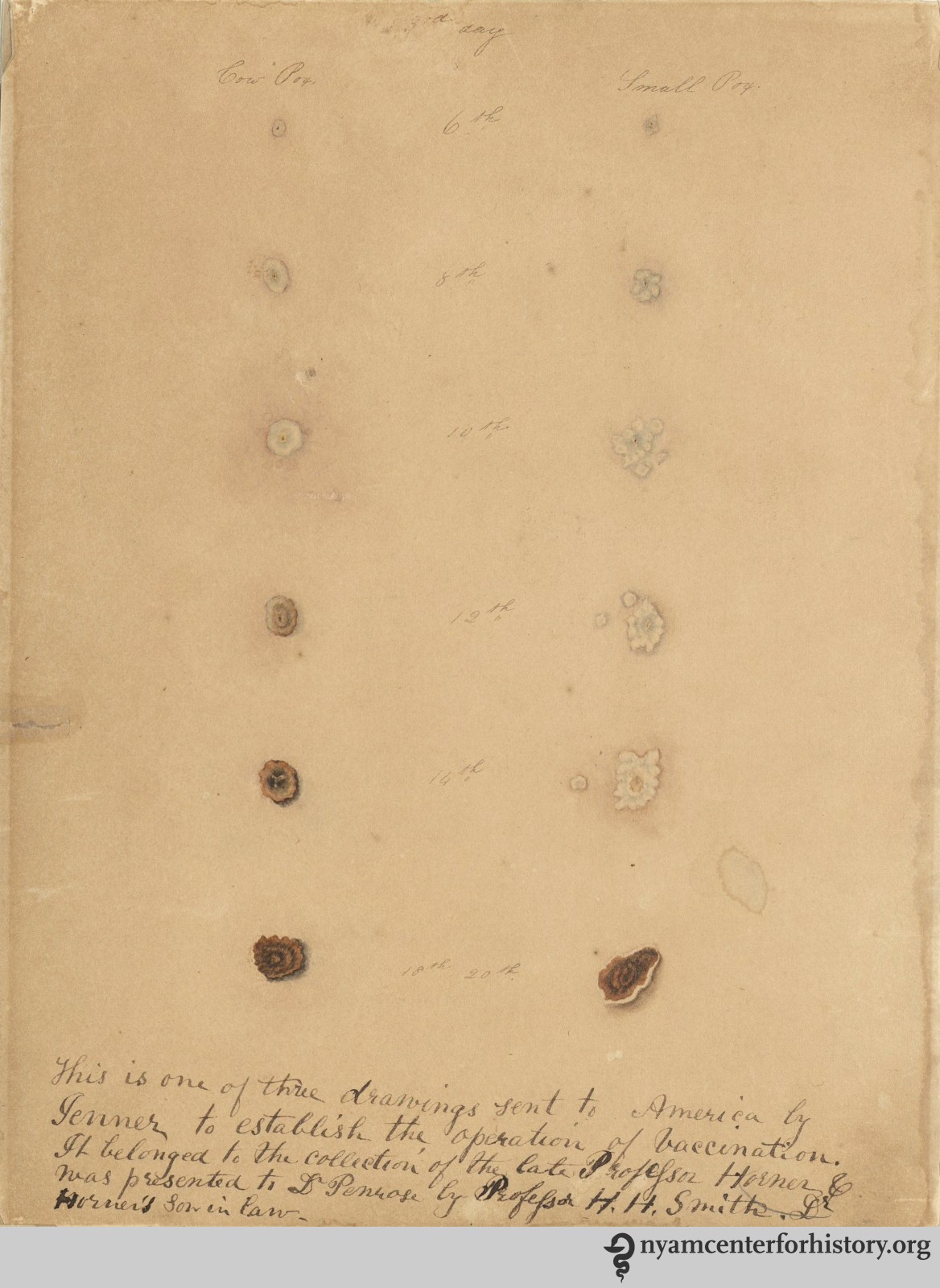 Edward Jenner and the Development of the Smallpox Vaccine | Books ...