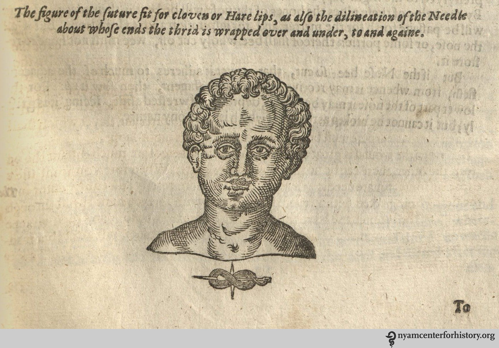 The Language of Textiles and Medicine | Books, Health and History