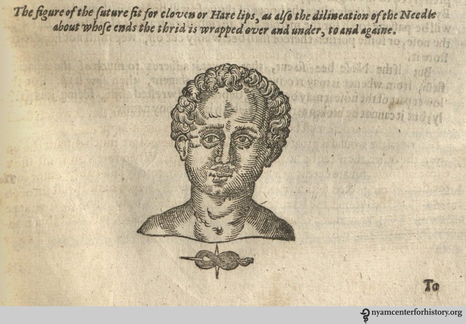 The Language of Textiles and Medicine | Books, Health and History